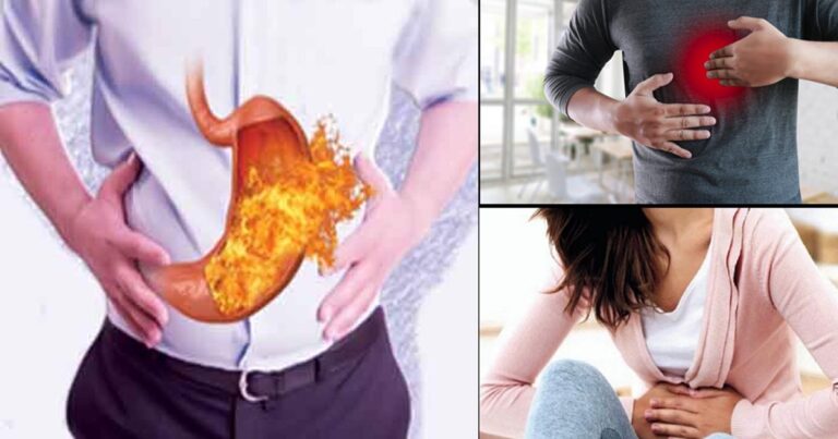 Symptoms and Treatments for Stomach Acidity